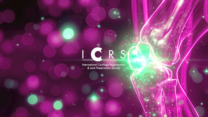 AGA Ready for Surgery - #004: Wie operiere ich eine Bankart-Läsion ...